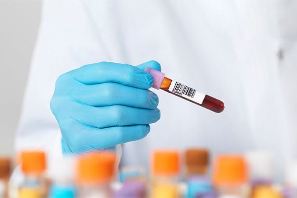 The Function of Additives in Blood Collection Tube - Nanjing Superfit I ...